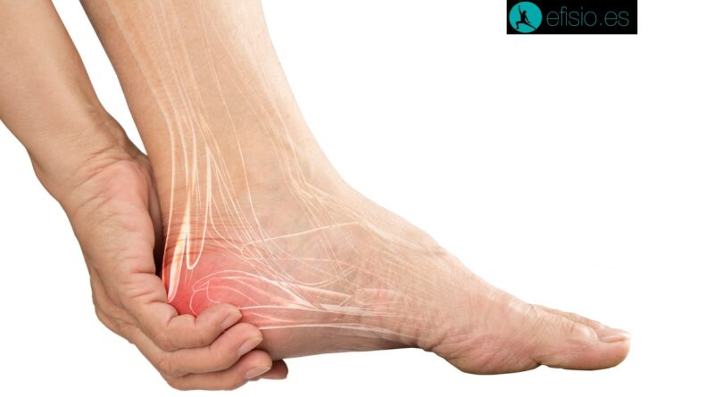 Dolor en el talón: causas y tratamientos | eFISIO Fisioterapia Madrid