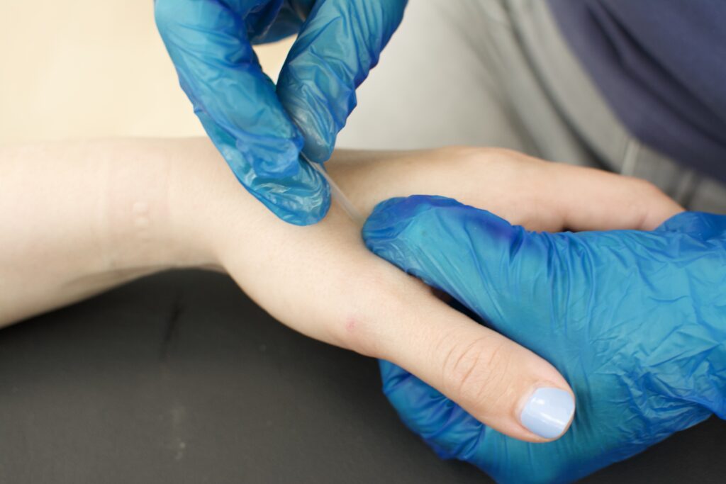 Me duele el dedo gordo de la mano: por qué y qué hacer